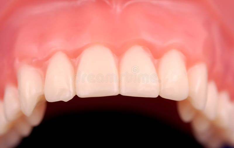 Upper Teeth stock image. Image of medical, enamel, clean - 401111
