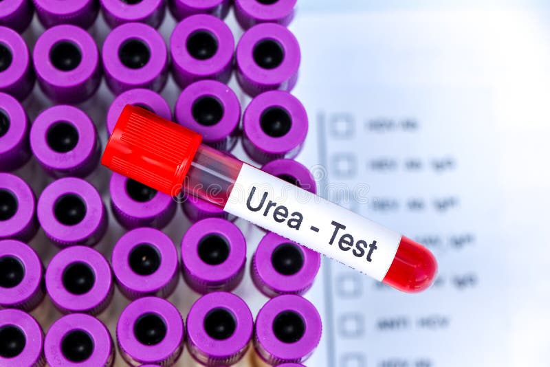 Urea Test To Look for Abnormalities from Blood Stock Photo - Image of ...
