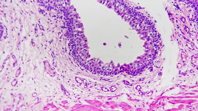 Urethra of Human Being in Section Filmed with 400x Magnification Under ...