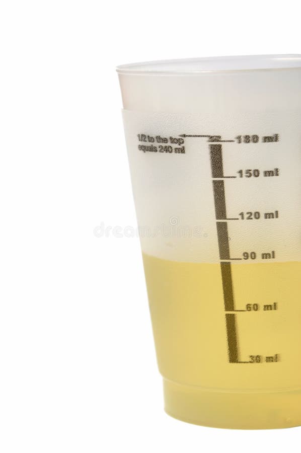 Glas Mit Urinprobe Auf Tabelle Urologiekonzept Stockbild - Bild von ...