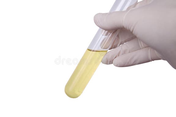 Urin sample stock image. Image of check, experiment, health - 11241283