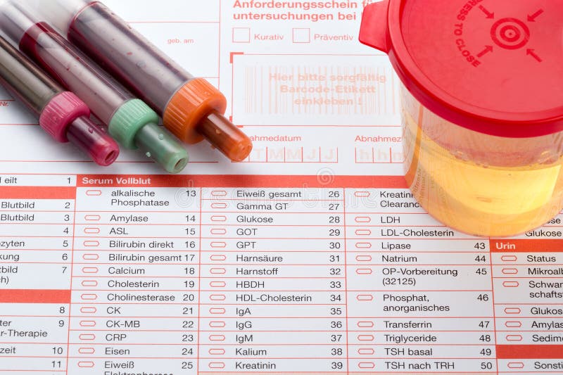 Blutprobe, Blutproben Auf Einem Labor Bilden Sich Stockbild - Bild von ...