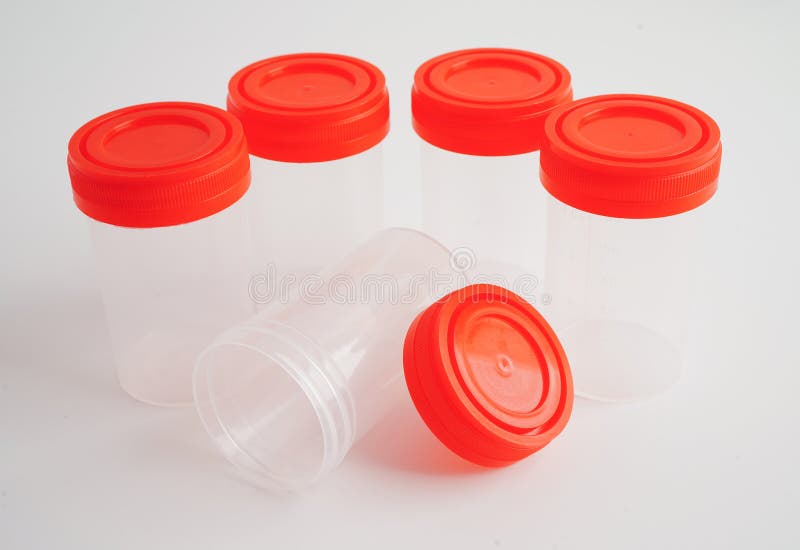 Urinalysis, Urine Cup for Check Health Examination in Laboratory Stock ...