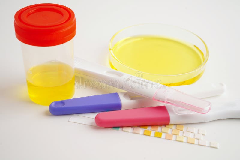 Urinalysis, Urine Cup with Reagent Strip PH Paper Test and Comparison ...