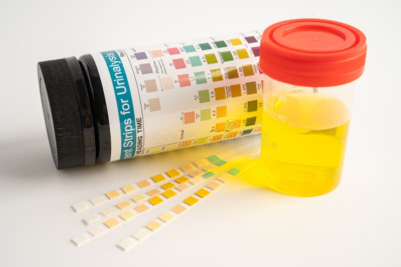 Urinalysis, Urine Cup with Reagent Strip PH Paper Test and Comparison ...