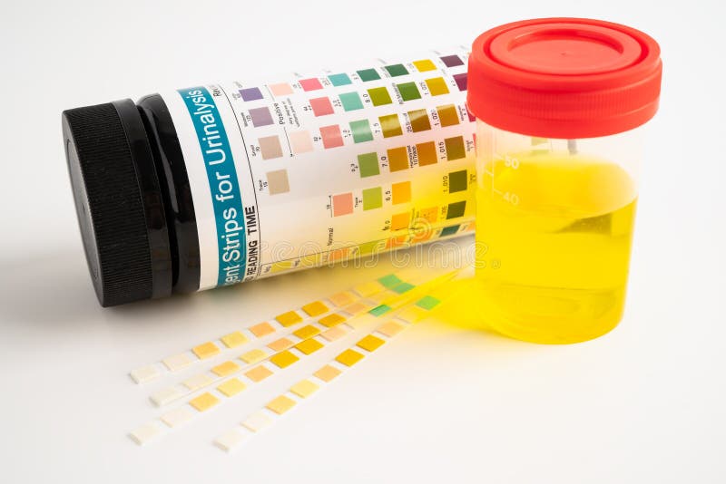 Urinalysis, Urine Cup with Reagent Strip PH Paper Test and Comparison ...