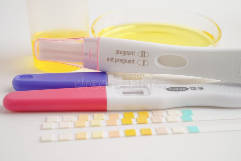 Urinalysis, Urine Cup with Reagent Strip PH Paper Test and Comparison ...