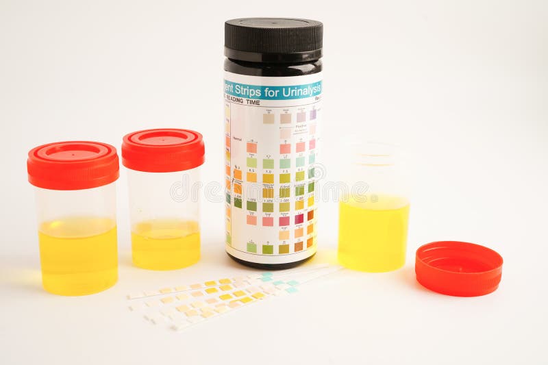 Urinalysis, Urine Cup with Reagent Strip PH Paper Test and Comparison ...