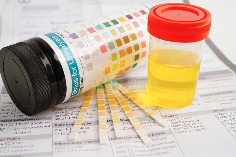 165 Filter Paper Laboratory Stock Photos - Free & Royalty-Free Stock ...