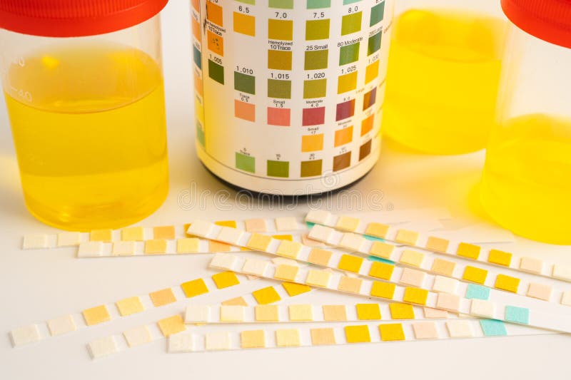Urinalysis, Urine Cup with Reagent Strip PH Paper Test and Comparison ...
