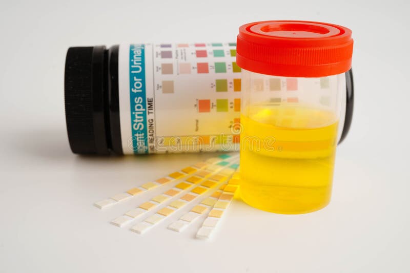 Urinalysis, Urine Cup with Reagent Strip PH Paper Test and Comparison ...
