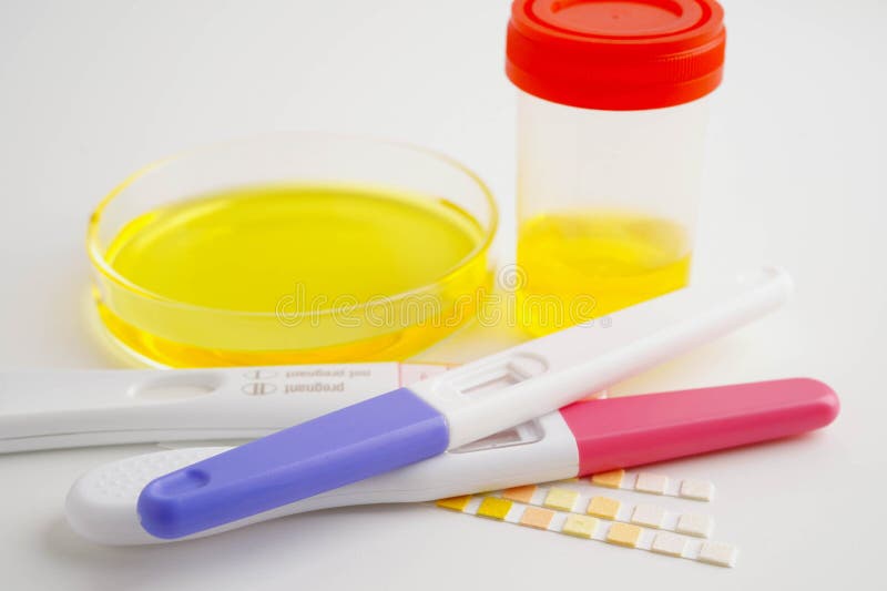 Urinalysis, Urine Cup with Reagent Strip PH Paper Test and Comparison ...