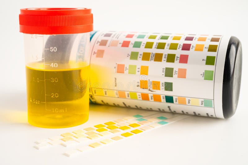 Urinalysis, Urine Cup with Reagent Strip PH Paper Test and Comparison ...