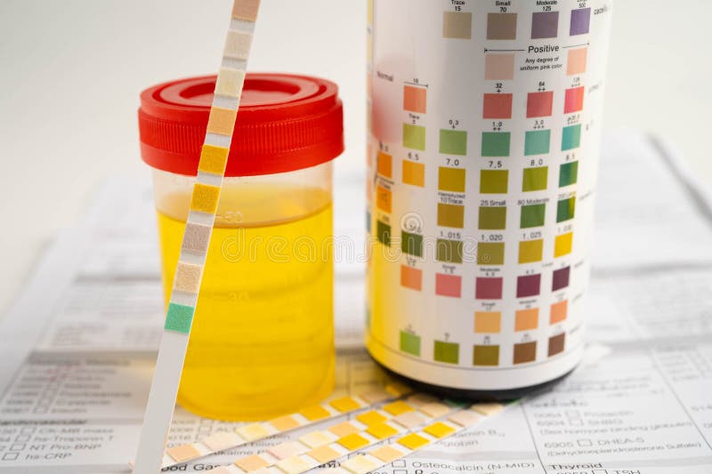 Urine Strip Test for Urinalysis. Stock Photo - Image of urine, organ ...