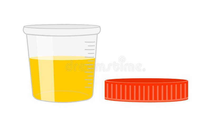 Urinalysis. Urine Sample, Full Open Plastic Container with Removed ...
