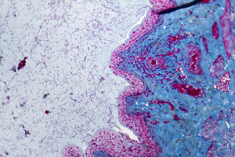 Urinary bladder micrograph stock image. Image of research - 83715681