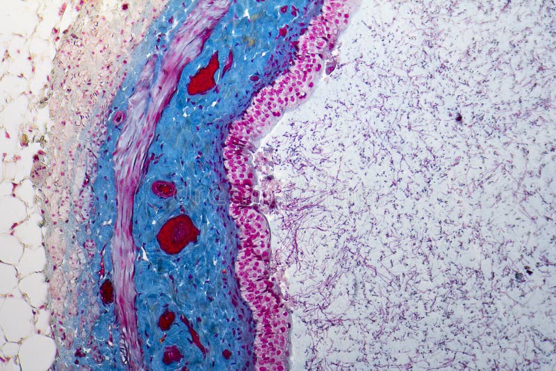 Urinary bladder micrograph stock image. Image of thin - 83716525