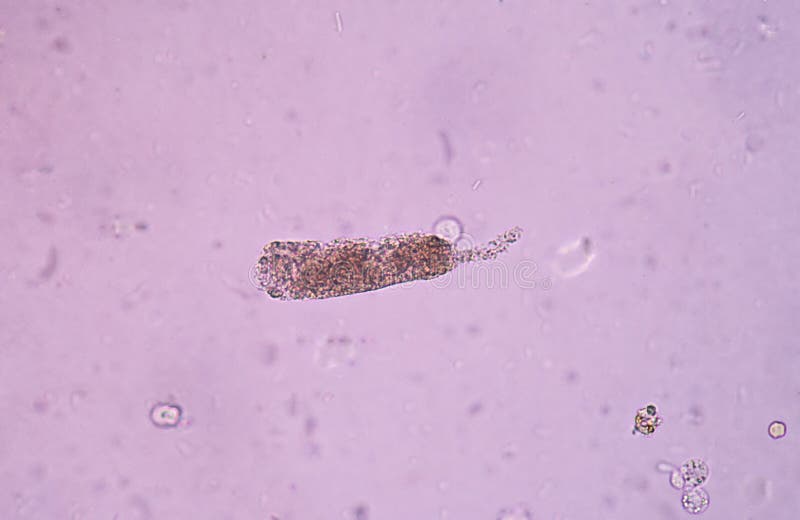 Urinary Casts Fine Granular Cast. Stock Photo - Image of hydrochloric ...