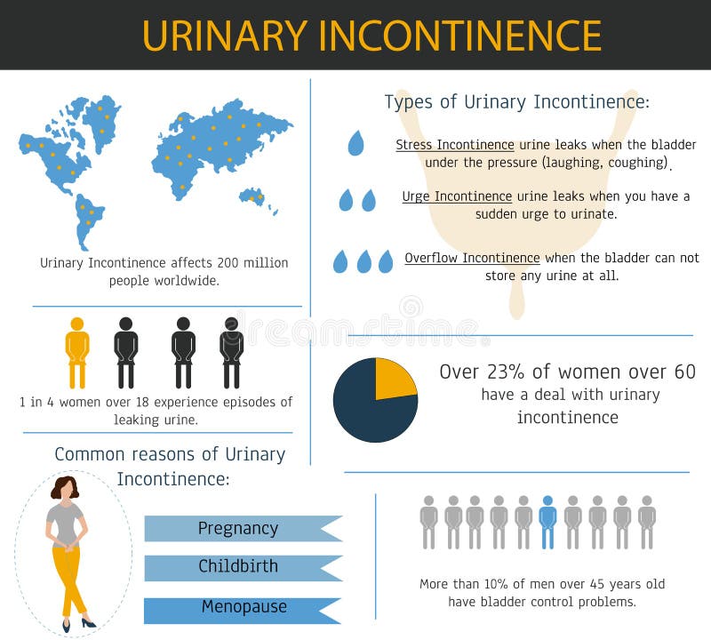 Urinary Incontinence Infographic. Stock Vector - Illustration of people ...
