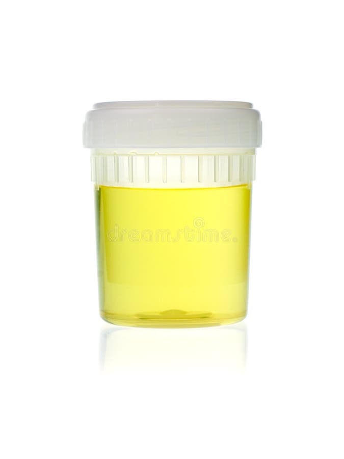 Urine Sample stock image. Image of healthy, test, healthcare - 5148015