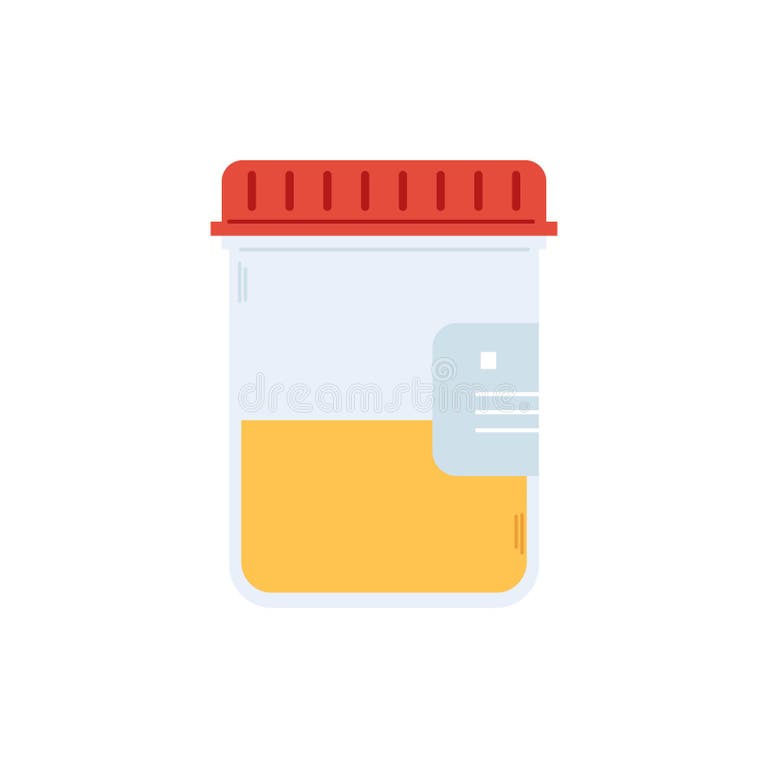 Urine Analysis. Container with Pee Sample. Plastic Containers with ...