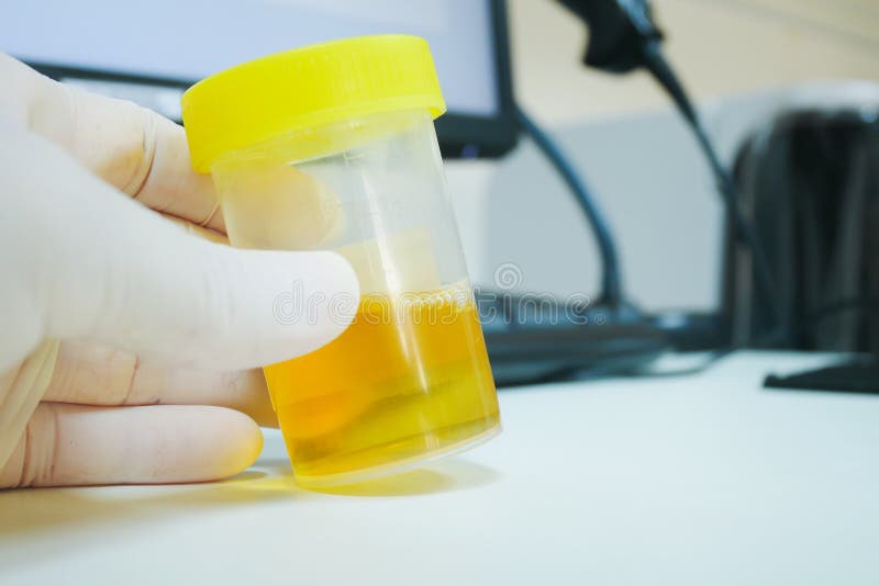 Urine Analysis in Laboratory Stock Image - Image of health, chemical ...