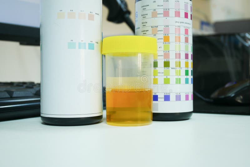 Urine Analysis in Laboratory Stock Photo - Image of check, clinic: 305999148