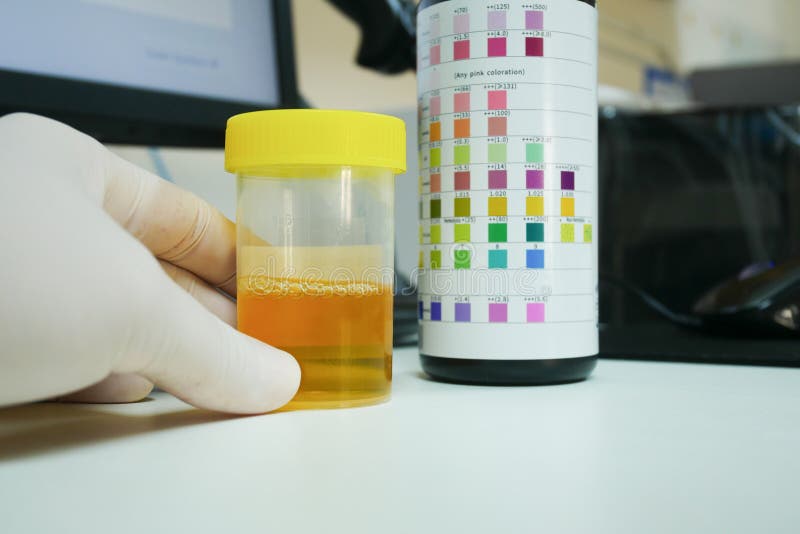Urine Analysis in Laboratory Stock Photo - Image of exam, examination ...