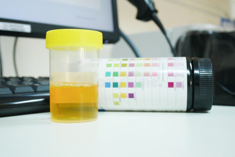 Urine Analysis in Laboratory Stock Photo - Image of medicine, diagnosis ...