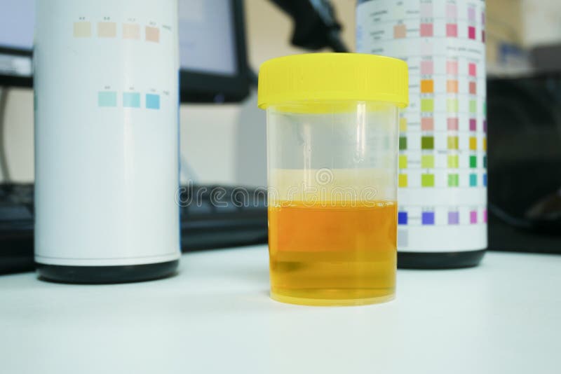 Urine Analysis in Laboratory Stock Photo - Image of kidney, litmus ...