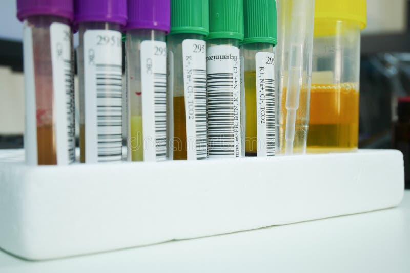 Urine Analysis in Laboratory Stock Image - Image of chemical, bottle ...