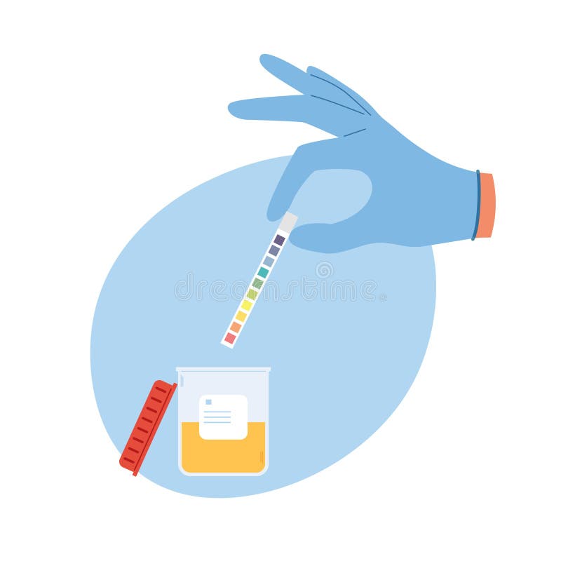 Urine Test Strip Stock Illustrations – 634 Urine Test Strip Stock ...