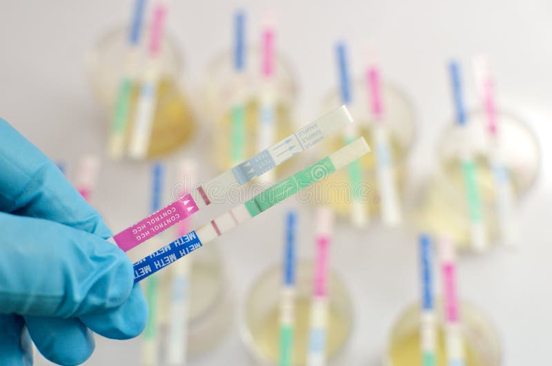 Urine analysis stock image. Image of urine, chemistry - 54807473