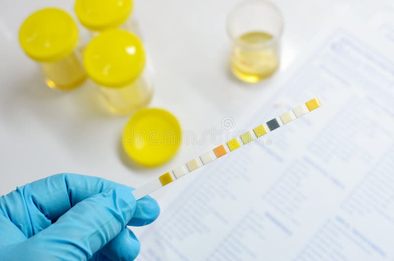 Urine analysis stock image. Image of examination, medical - 25306397