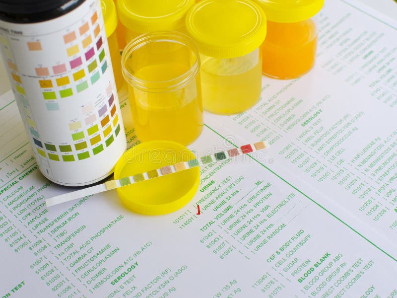 Urine analysis stock image. Image of scientific, health - 58176045