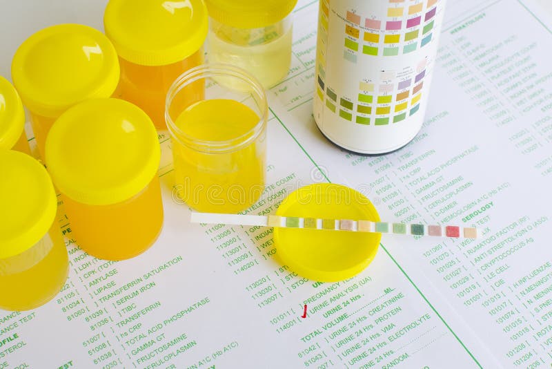 Urine analysis stock photo. Image of research, experiment - 58176090