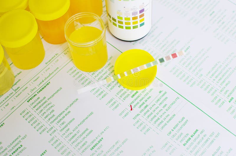 Urine analysis stock image. Image of hospital, chemistry - 33158665