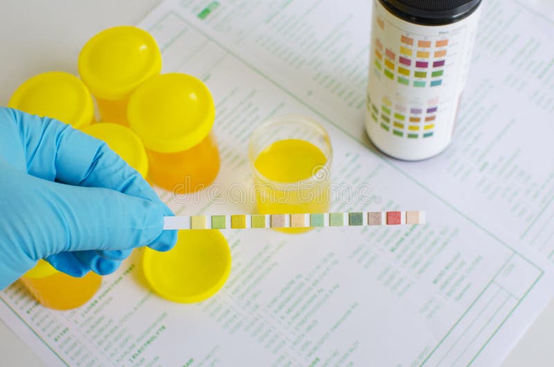 Urine analysis stock image. Image of hospital, chemistry - 33158665