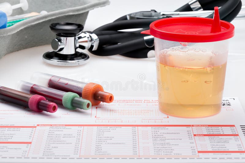 Urine and Blood Test (complete Blood Count) Stock Image - Image of ...