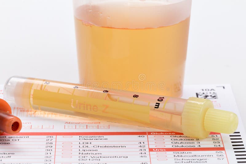 Urine and Blood Test (complete Blood Count) Stock Photo - Image of ...