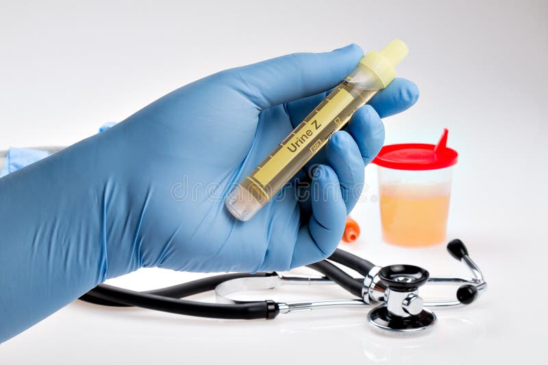 Urine and Blood Test (complete Blood Count) Stock Photo - Image of ...