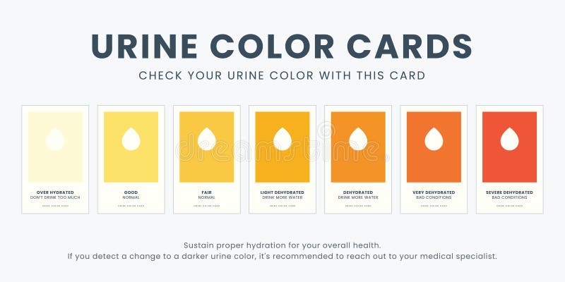 The Urine Color Cards. Isolated Vector Illustration Stock Vector ...