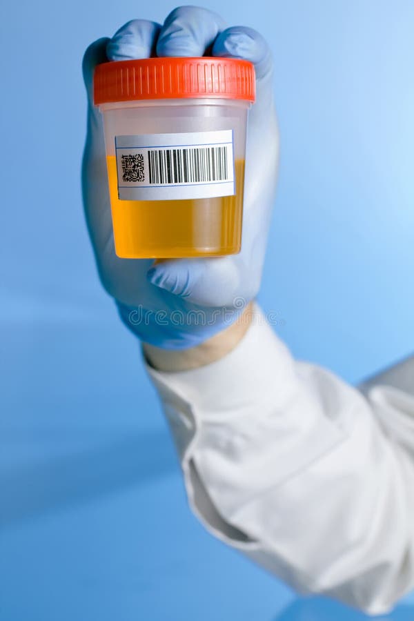 Urine Container with Code Bar in Blue Background Stock Photo - Image of ...