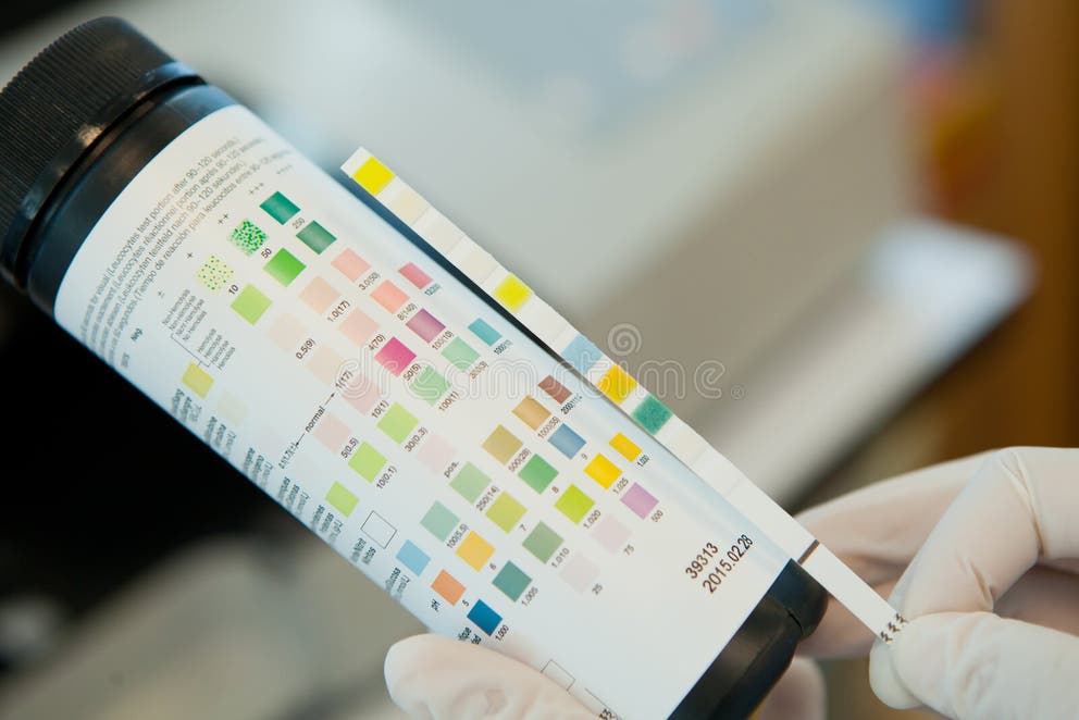 Urine Diagnostic Reagent Test Strips Stock Photo - Image of checkup ...