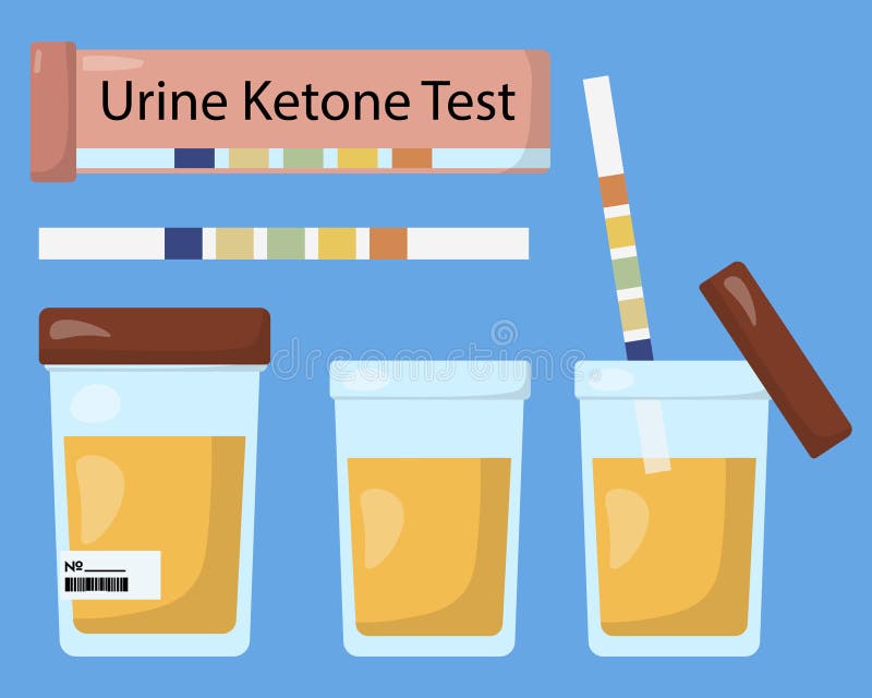 Urine Ketone Test Set, Acetone Test Strips and Containers with Urine ...