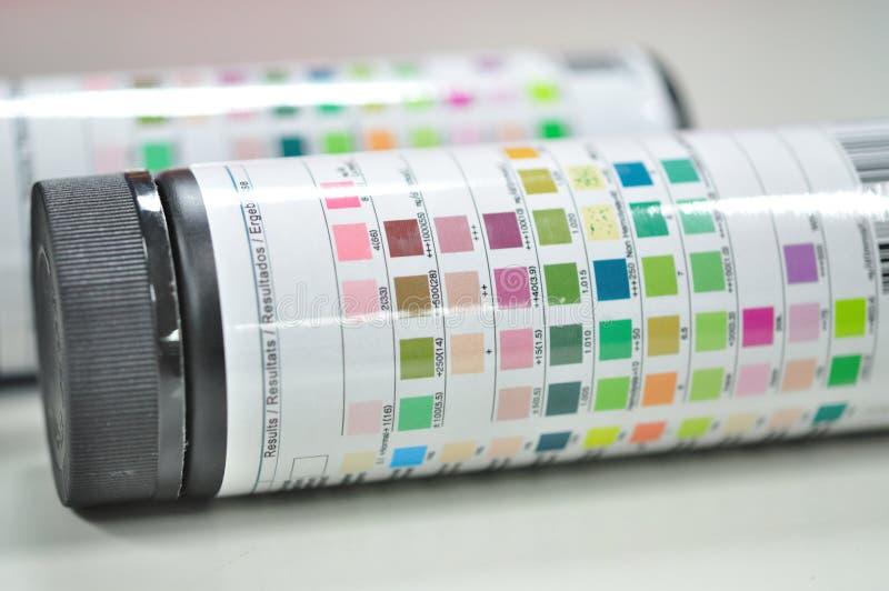 Urine Strip Test for Urinalysis. Stock Photo - Image of urine, organ ...