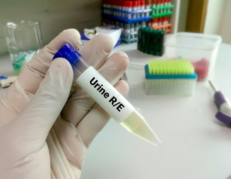 Urine routine examination stock image. Image of cell - 275615335