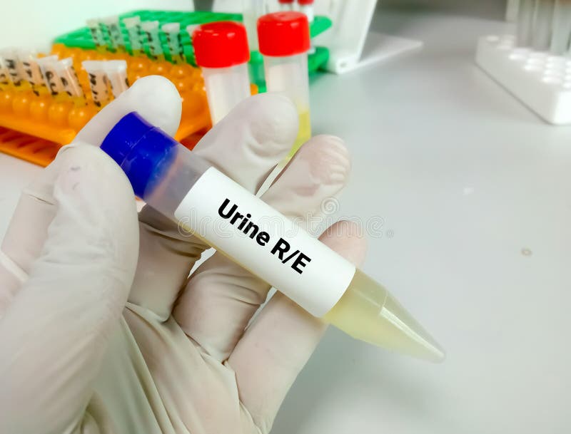 Urine routine examination stock photo. Image of medical - 275615340