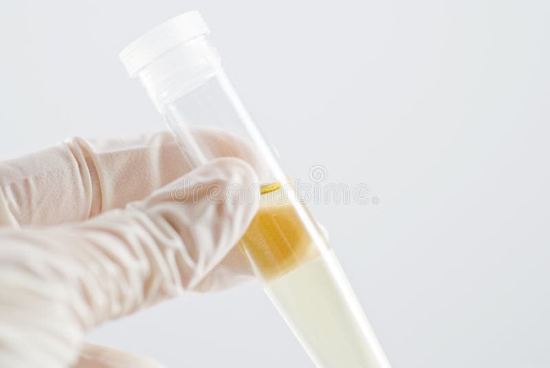 Urine sample stock image. Image of exam, anatomy, nurse - 542859