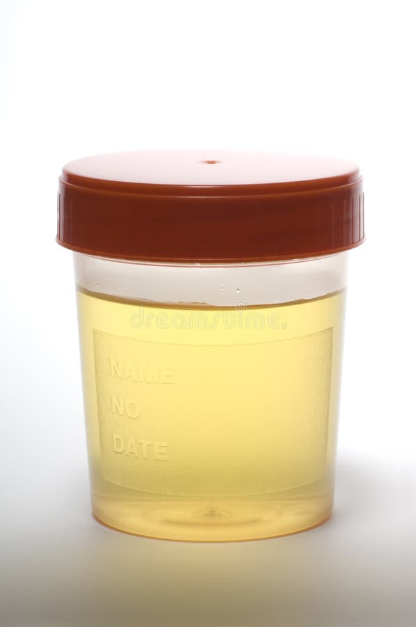 Urine Sample stock image. Image of method, plastic, yellow - 19030263